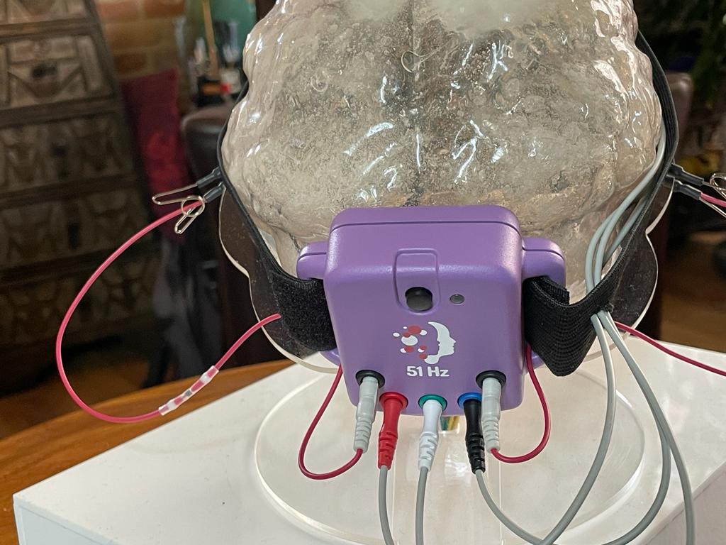 EEG scan from 51hz replaces lengthy psychological diagnostic testing ...